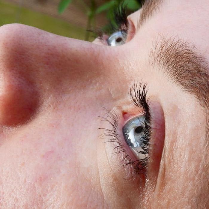 Blessure aux yeux : que faire